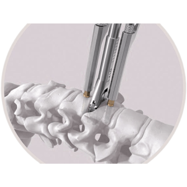 Prodisc® C Vivo - Société Spinaxis : experts en DMs